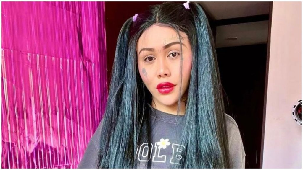 “Olía a mortecina”: Yina mostró la impactante herida que se le abrió en ...